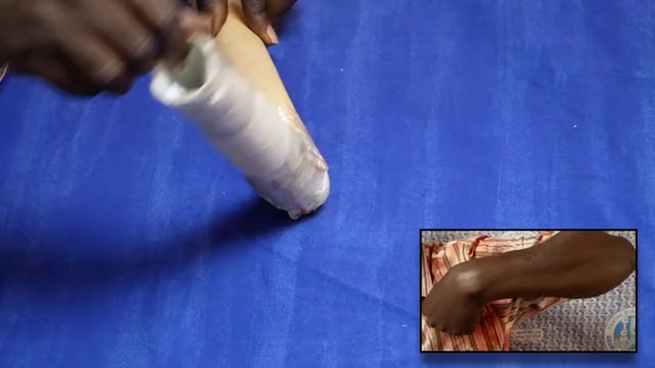 PodEduc - Épaule.Mp4