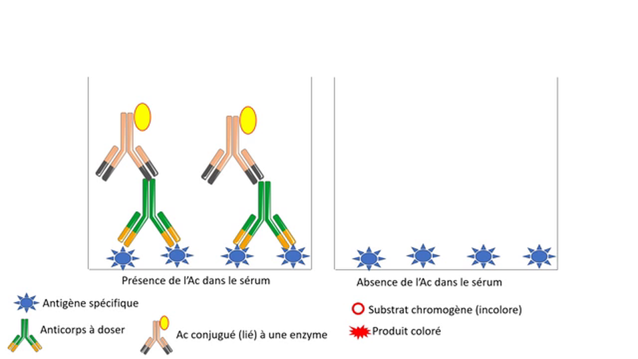 PodEduc - Techniques Elisa.Mp4