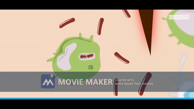 PodEduc - Reaction Inflammatoire Recoupée.Mp4