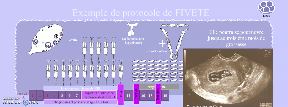 PodEduc - Un Exemple De Protocole De Fivete